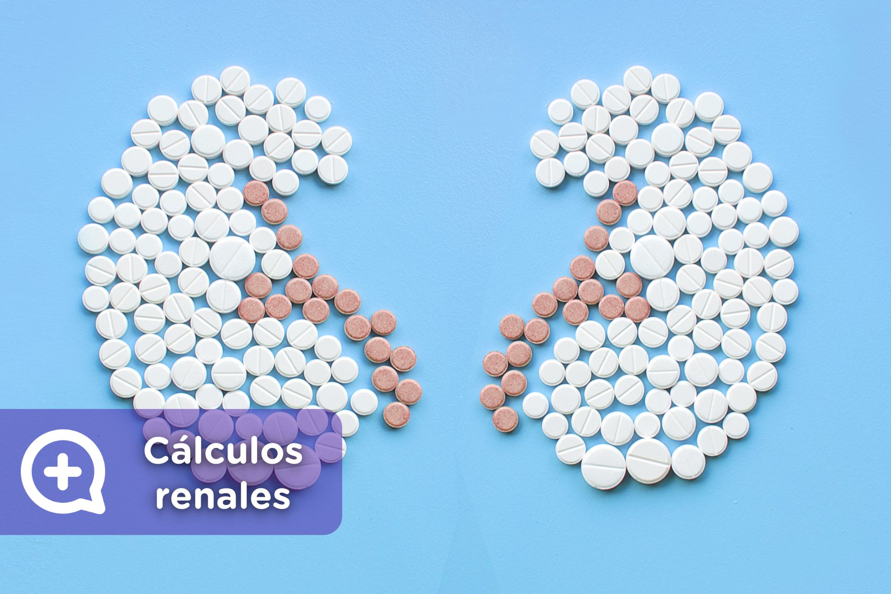 Cálculos renales: cómo evitar las piedras en el riñón - mediQuo