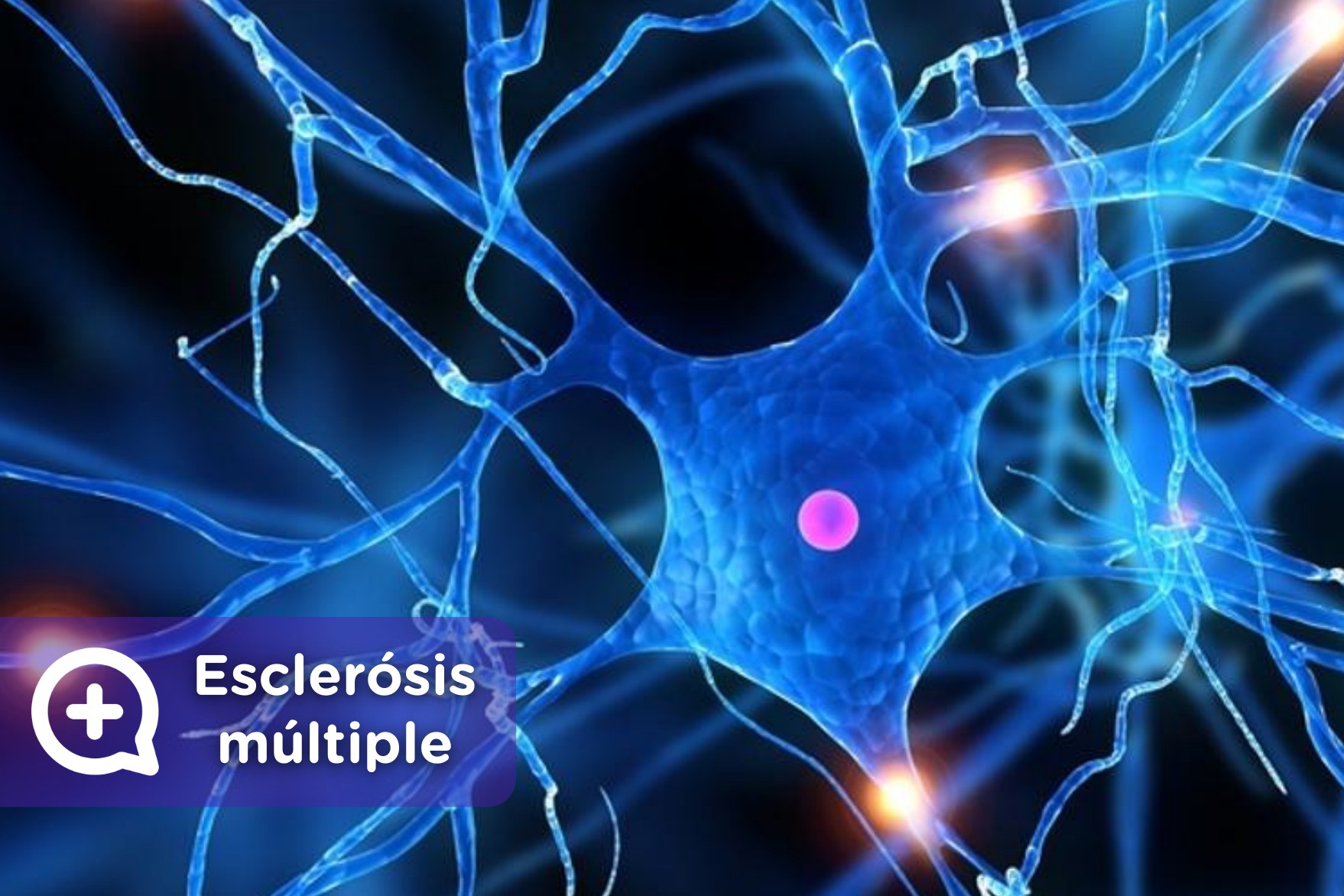 Esclerosis Múltiple, la enfermedad de las mil caras - mediQuo