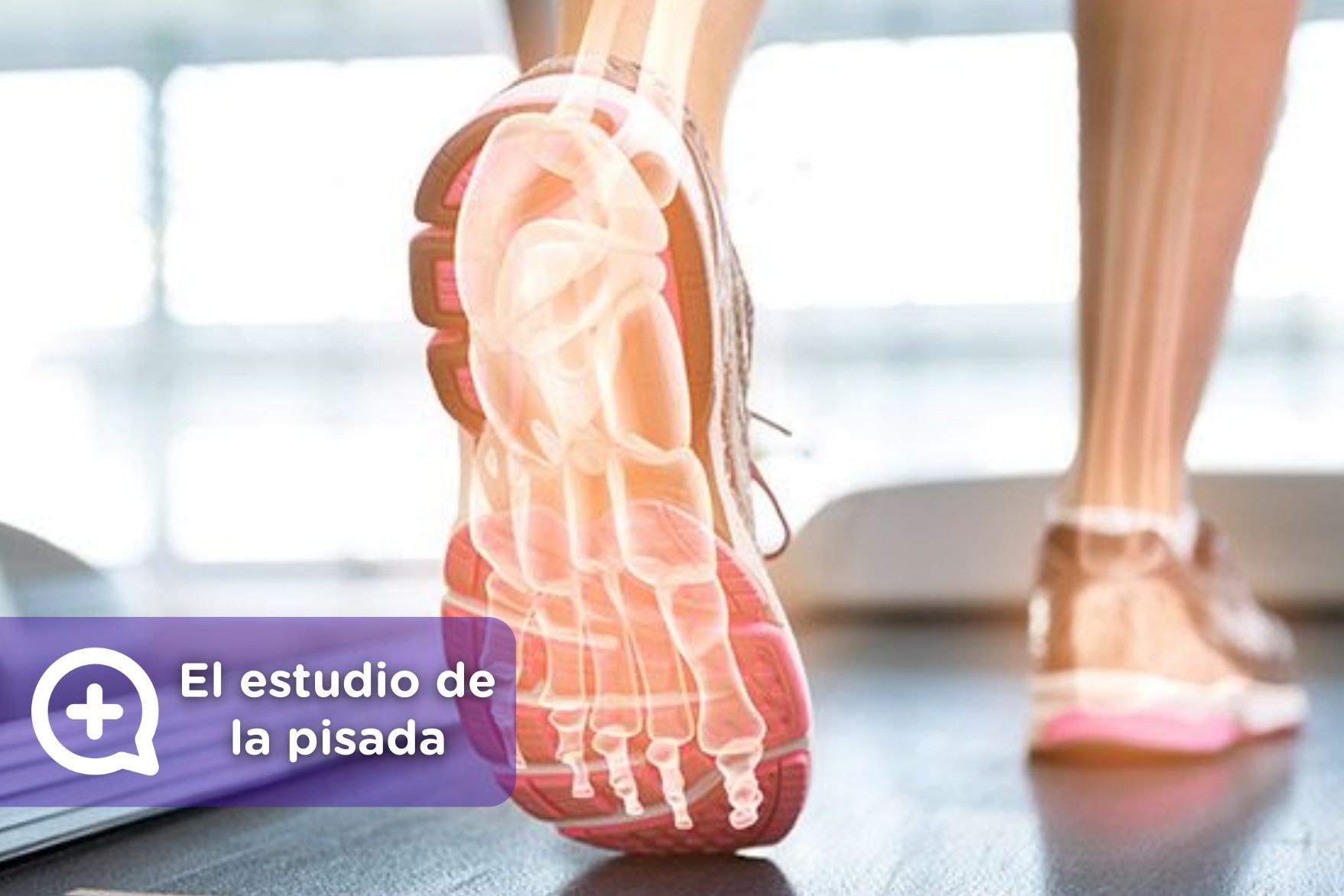 Dime cómo pisas y te diré por qué te duele todo el cuerpo. Así es de ...