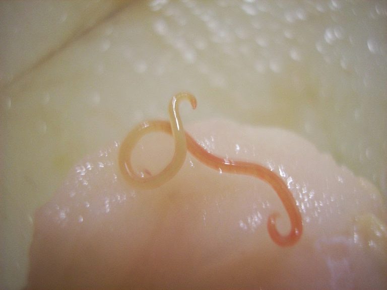 Anisakis, esto es lo que debes saber - mediQuo