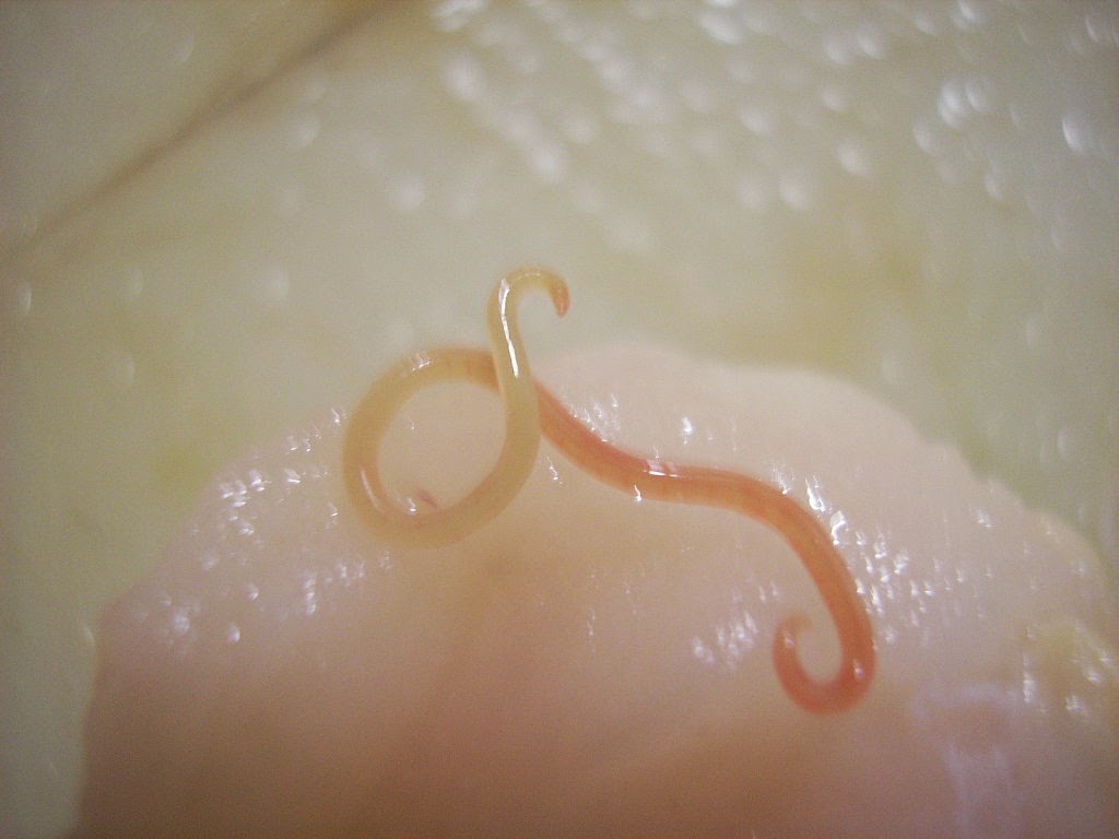 Anisakis, esto es lo que debes saber - mediQuo