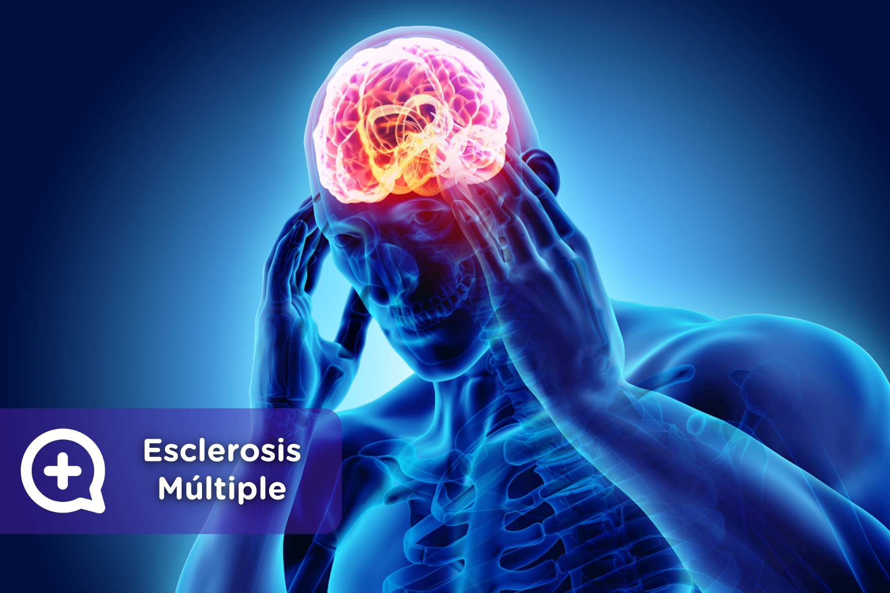 Esclerosis Múltiple: diagnóstico, síntomas y tratamiento - mediQuo