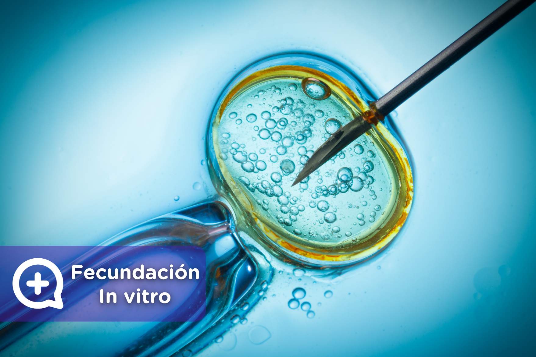 ¿Cuándo se debe realizar la Fecundación In vitro? - mediQuo