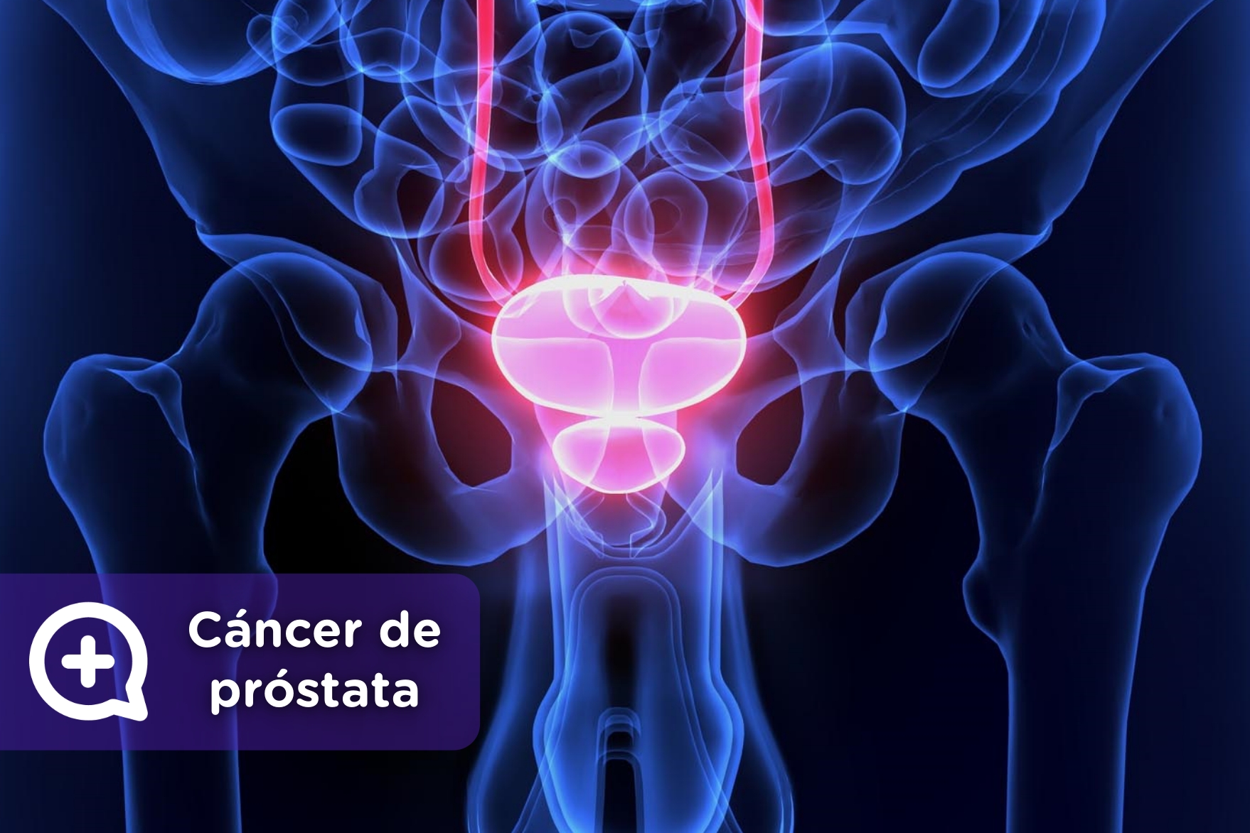 Cáncer de próstata: información y síntomas - mediQuo
